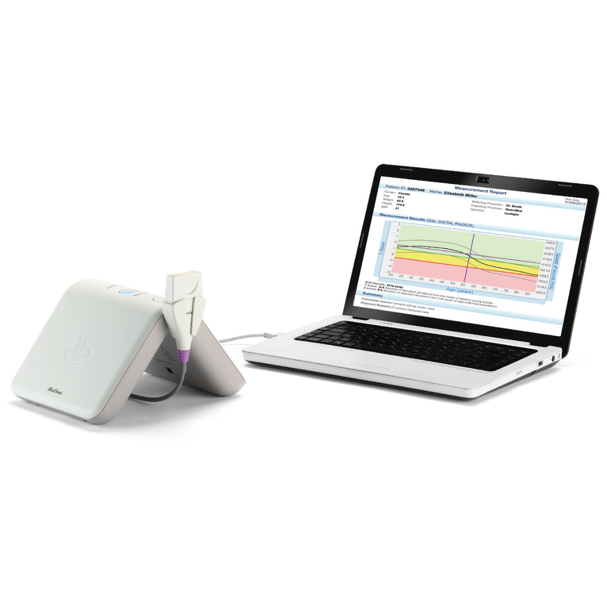 Sunlight MiniOmni Bone Densitometer - Ultrasound-based Osteoporosis Sc