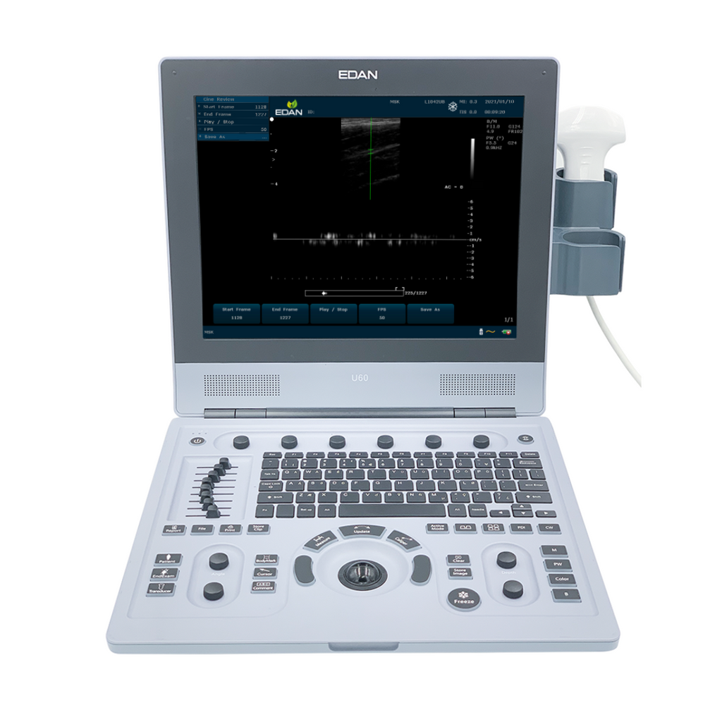 EDAN U60 Ultrasound Color. 15" Monitor w/2 Transducer Ports