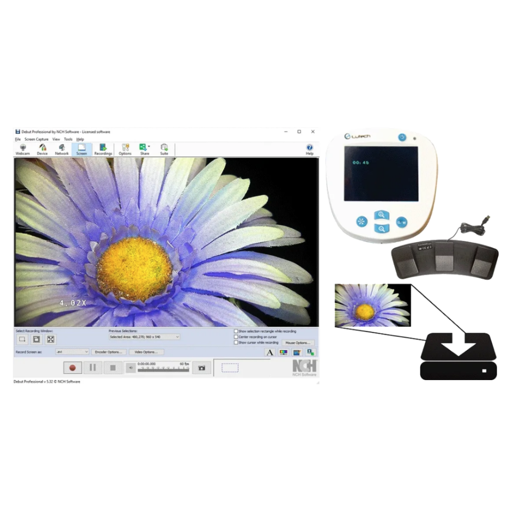 Lutech LT-300 HD Digital Video Colposcope High Definition